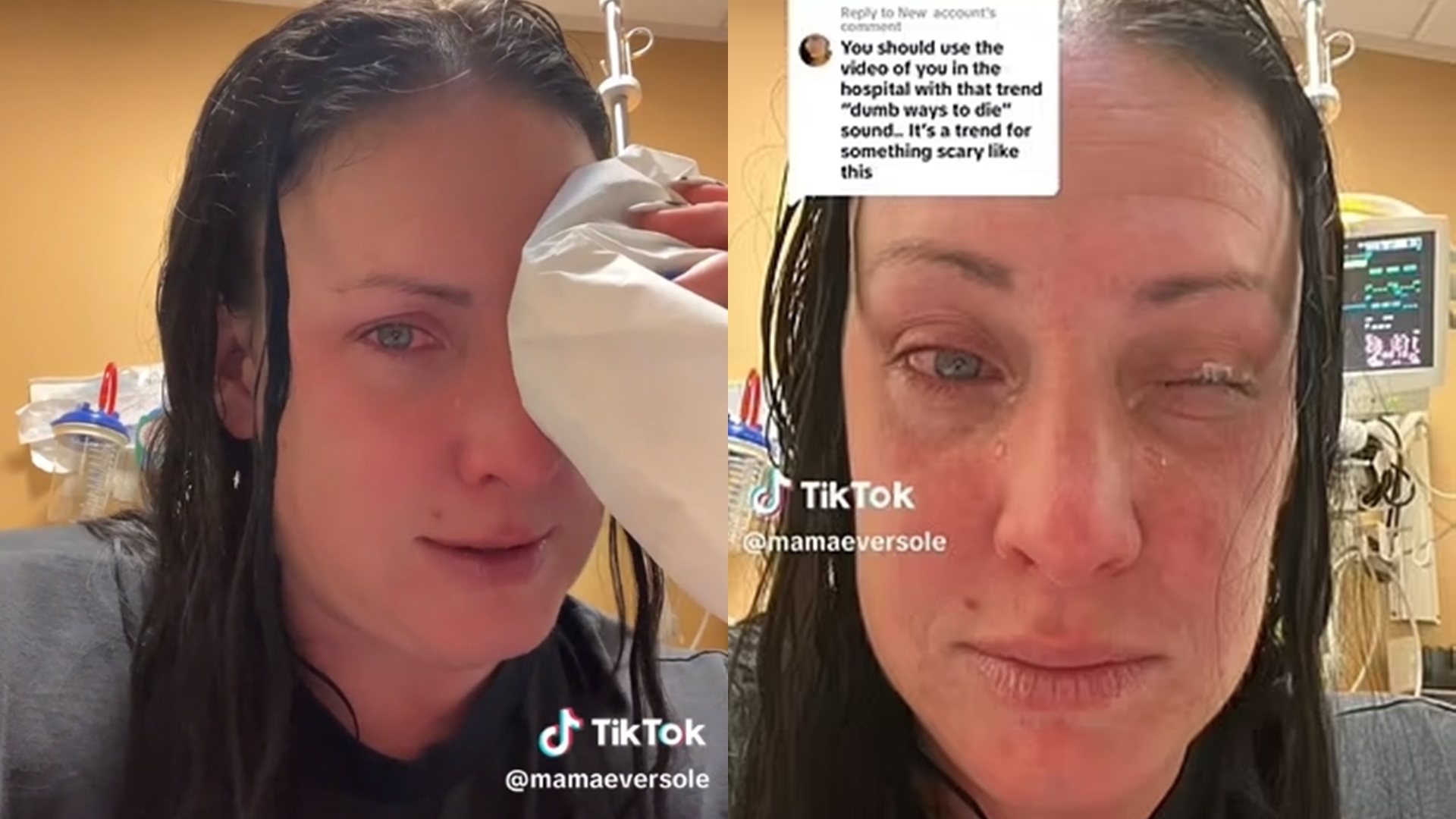 左眼突灼燒！她點眼藥水「竟拿成強力膠」 眼皮當場黏死急送醫 | 中天新聞網