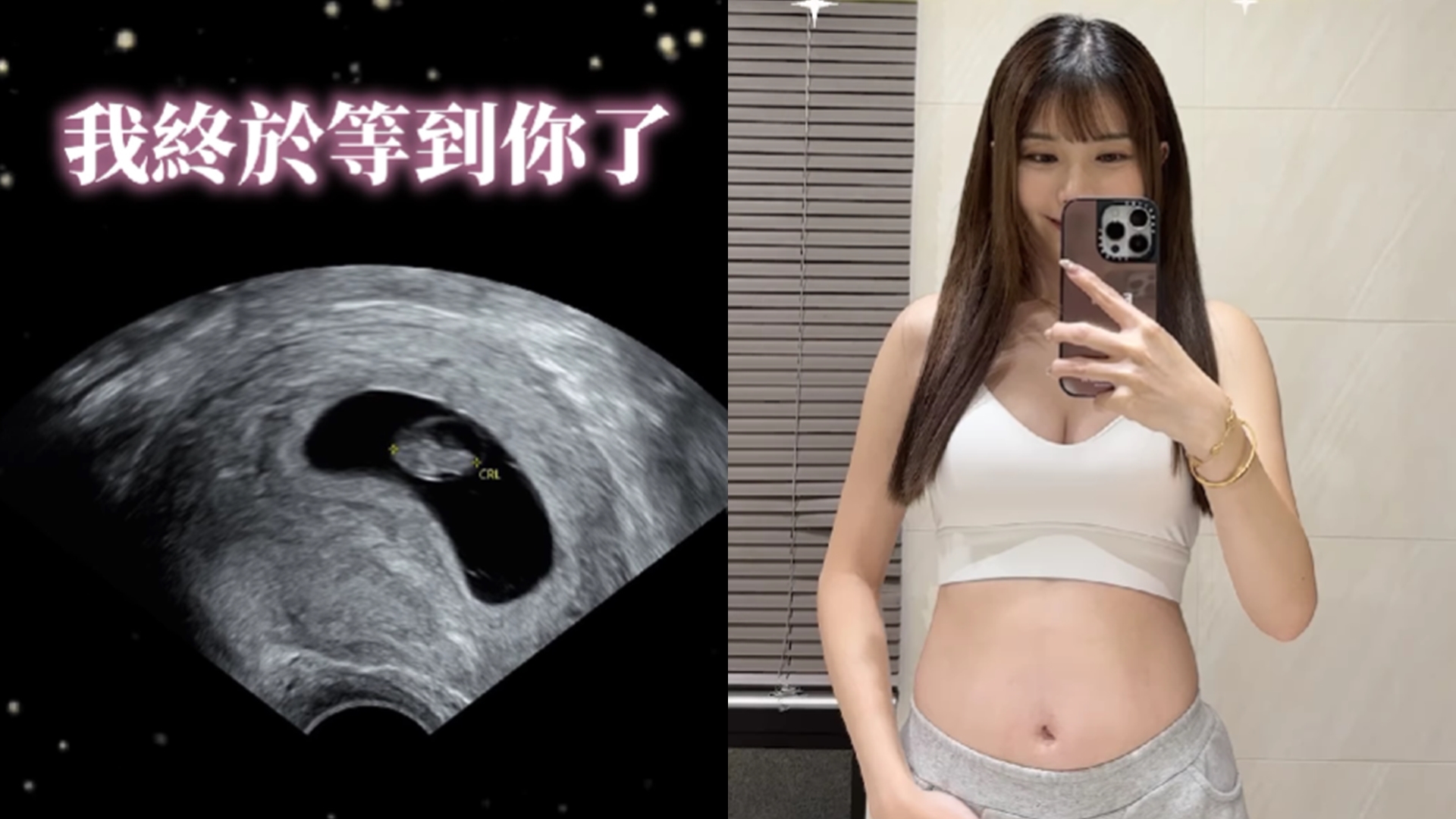 曾被醫告知「體質難受孕」YTR瑀熙苦求子一年終如願 備孕血淚史曝光 - ENews新聞網